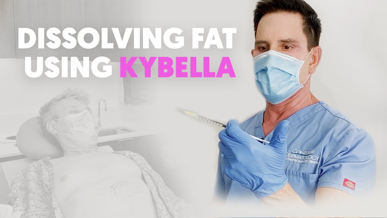 "Dissolving Fat" Using Kybella Injection - YouTube