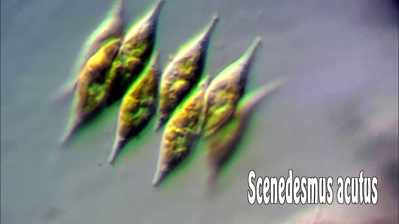 Scenedesmus acuminatus - YouTube