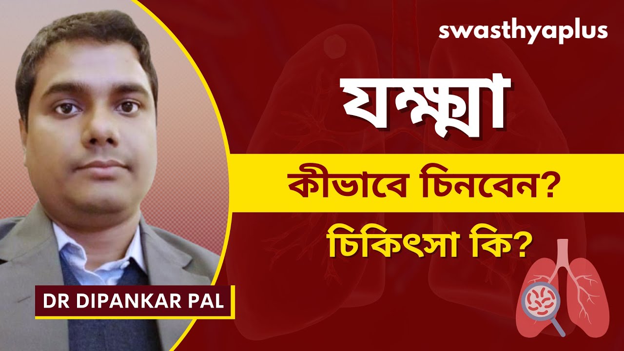 যক্ষ্মা: চিকিৎসা কি? | How to Treat Tuberculosis (TB)? in Bangla |Causes & Symptoms| Dr Dipankar ...