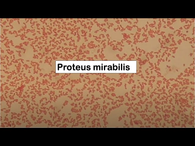 Proteus Morganii Gram Stain