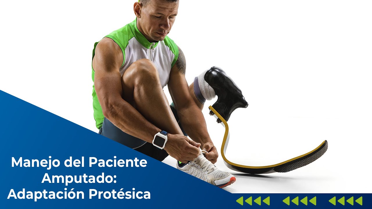 Fisioterapia en Manejo del Paciente Amputado: Adaptación protésica ...