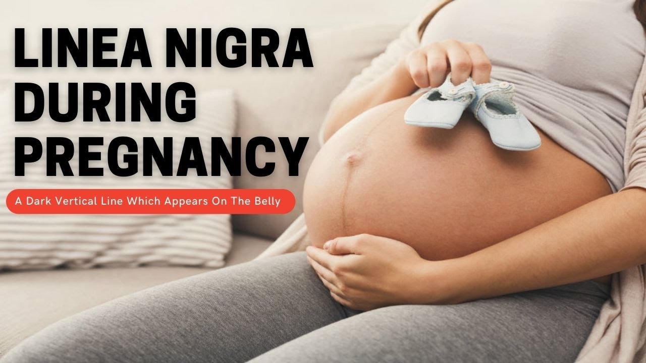 Linea Nigra During Pregnancy | Private Ultrasound Baby Scan clinic ...