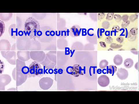 How to count WBC(Part 2) - Procedure - YouTube
