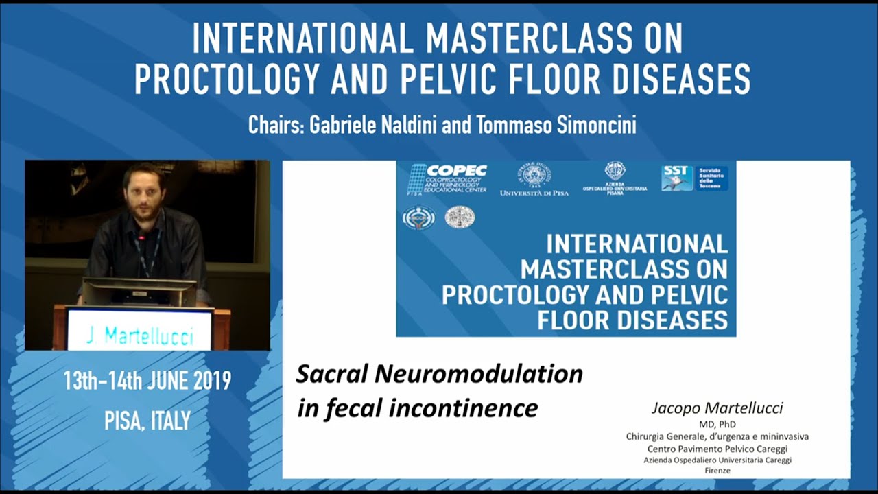 Sacral Neuromodulation for the treatment of fecal incontinence - Dr ...