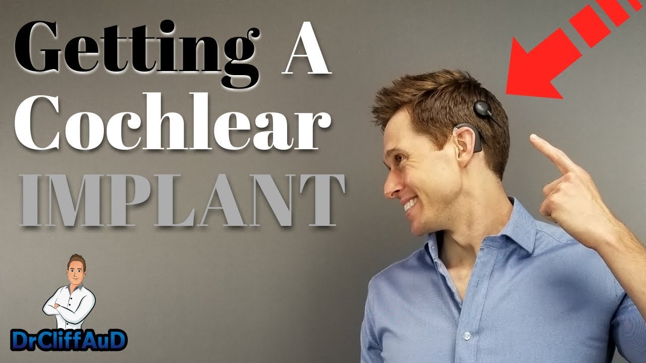 How To Get A Cochlear Implant | 3 Step Process - YouTube