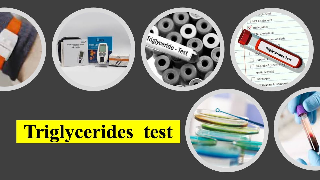Triglycerides test - Medical Lab Tests - What is ? , Uses , Need ...