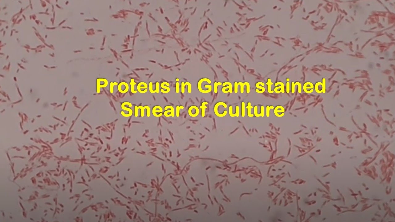 Proteus Spp Lecture