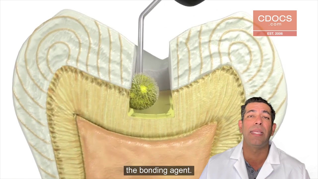 Tip of the Day: Adhese Universal - YouTube