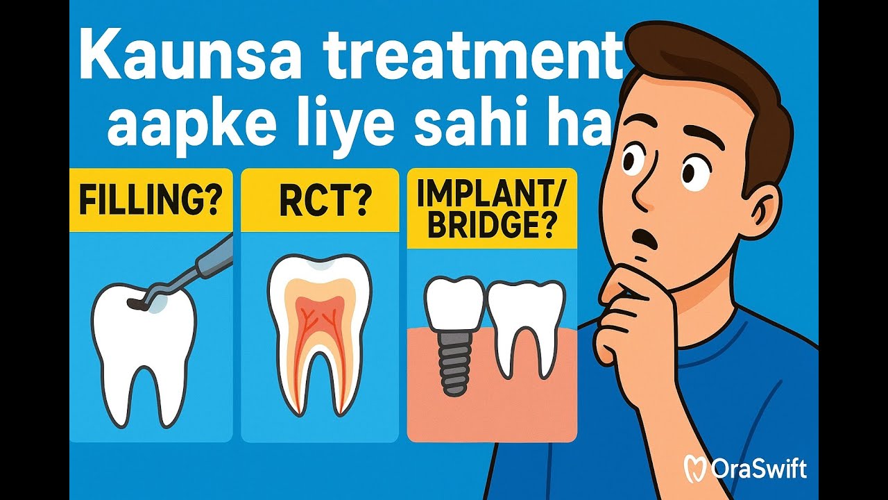 “Filling vs RCT vs Implant/Bridge – Kaunsa Treatment Aapke Liye Sahi ...