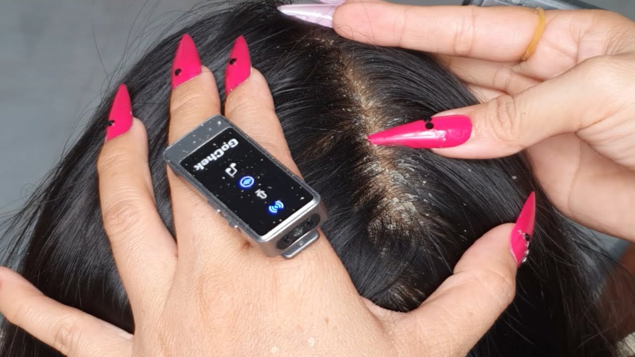 ASMR Scalp Rescue Mission 🚑 | Gentle Scratch, Pick & Relax Sounds # ...