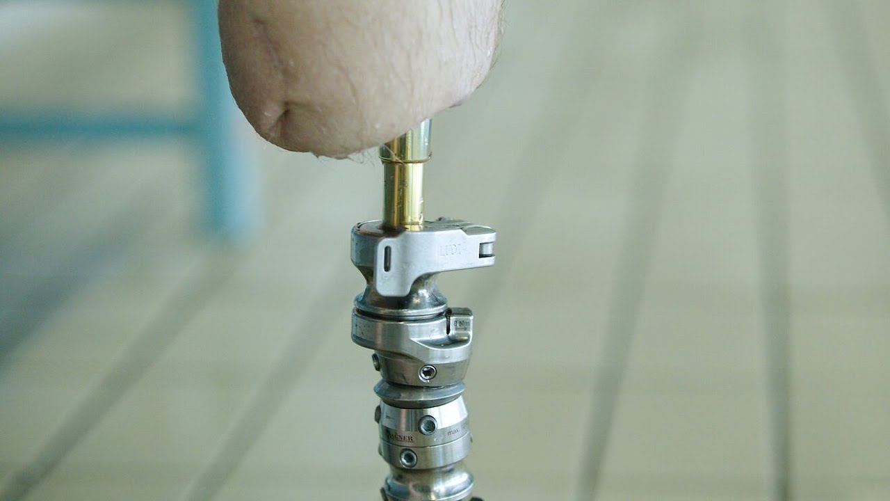 BADAL X - A revolution in bone anchored prosthetics - YouTube