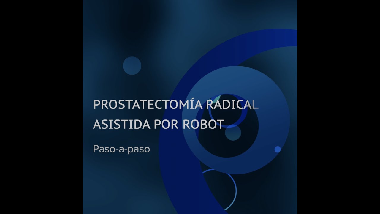 Prostatectomia Radical Robotica Paso a Paso - YouTube