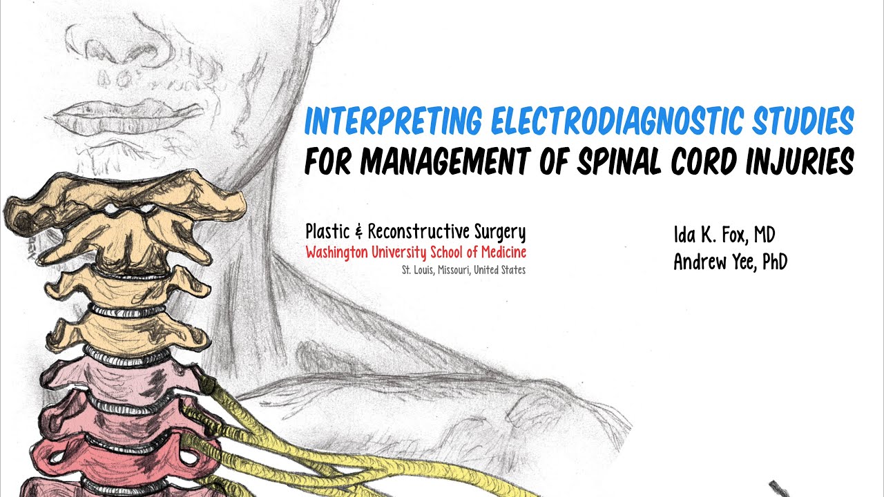 Interpreting Electrodiagnostic Studies for Management of Spinal Cord ...