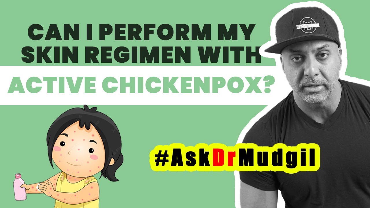 CAN I PERFORM MY SKIN REGIMEN WITH ACTIVE CHICKENPOX? - YouTube