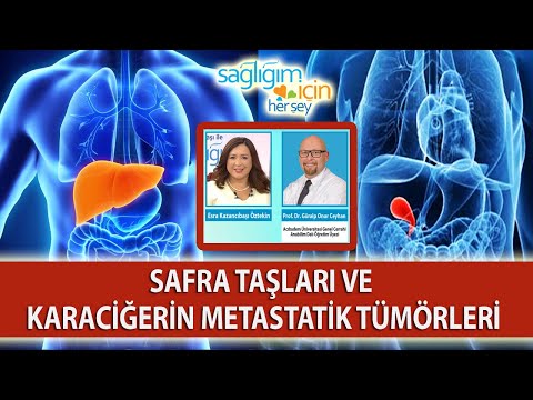 Safra Taşları ve Karaciğerin Metastatik Tümörleri