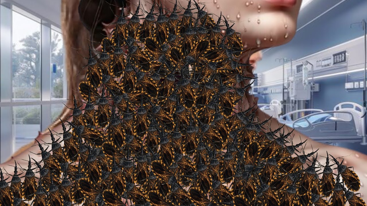 ASMR | Calm cleaning sticky bugs and relax treatment | neck animation ...