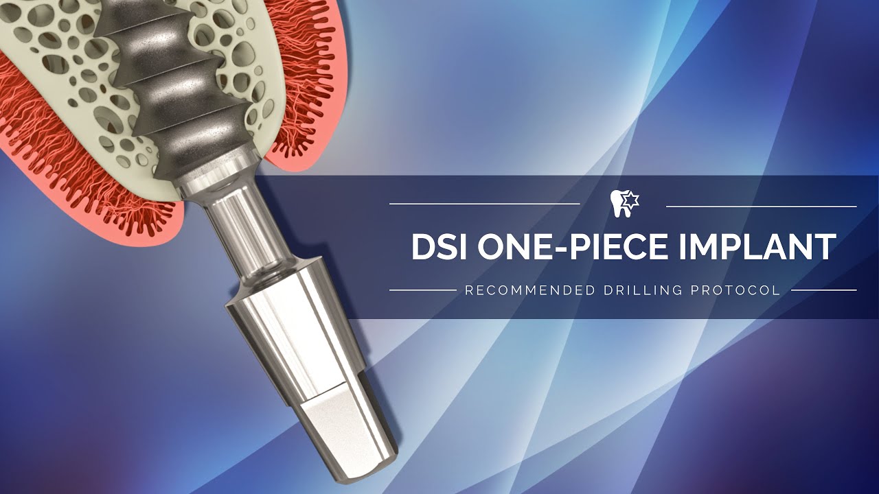 DSI One-piece Compressive Implant - Recommended Drilling Protocol - YouTube