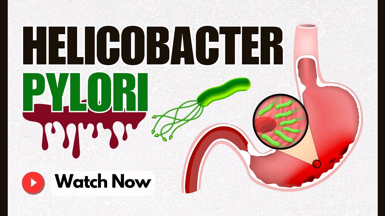 Helicobacter pylori: Pathogenesis, Transmission, its Effect on Stomach ...