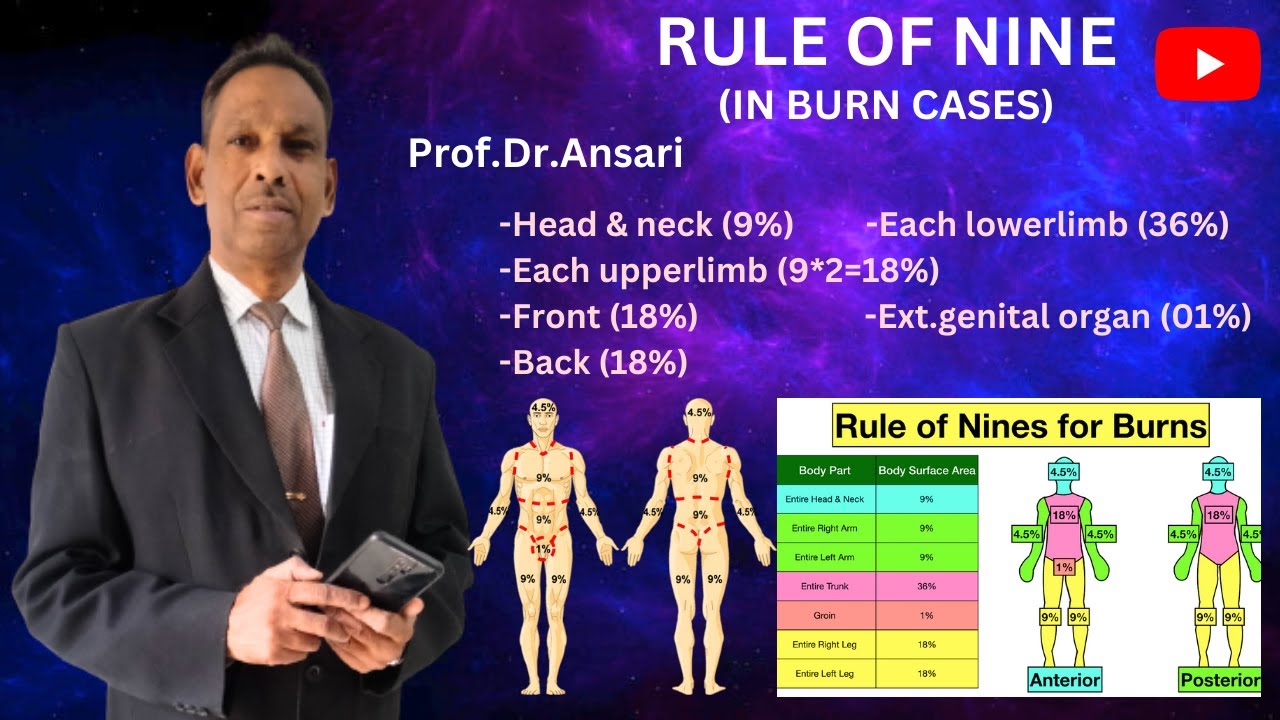 Rule of nine in burn cases| Head & Neck | Front & Back | Each lower ...