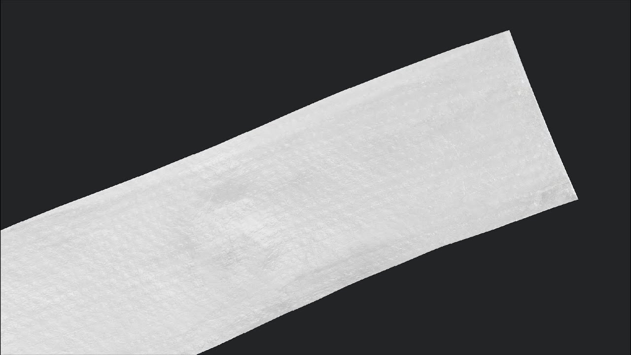 The Use of Biovance® Amniotic Membrane for Noninsertional Achilles ...