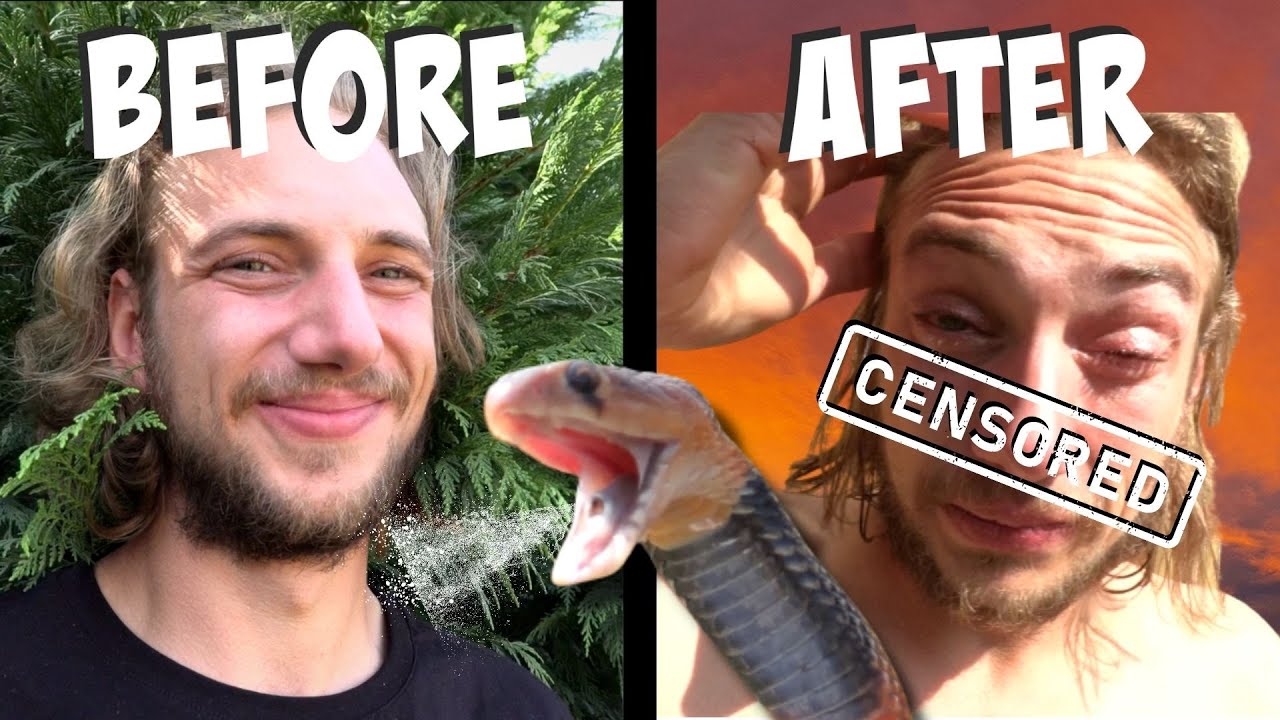 Human Test!!! Spitting Cobra Venom Spat Into Eye! - YouTube