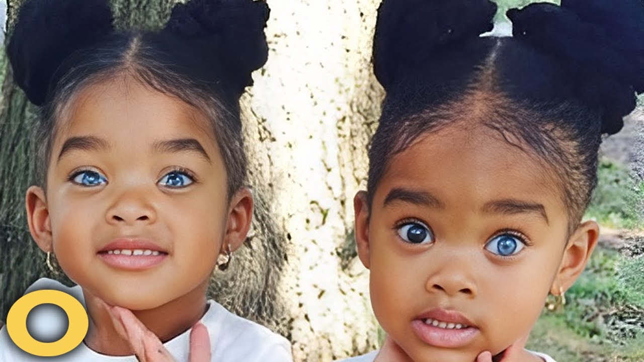 10 Most Rarest Twins Who Are One in A million - YouTube