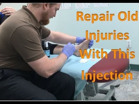 Prolotherapy--Restarting Your Body's Own Healing Process - YouTube