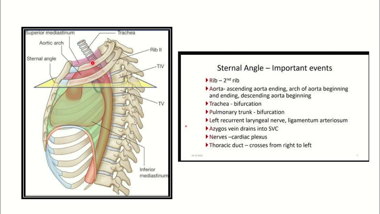 Angle of louis injury MRCS question solve (CRACK MRCS) - YouTube
