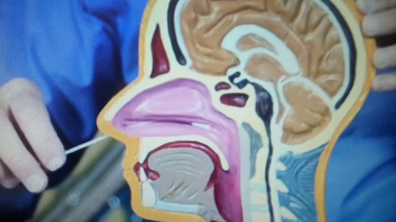 Oro pharyngeal swab - YouTube