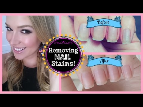 DIY: How To Remove Stains From Your Nails | MissJenFABULOUS