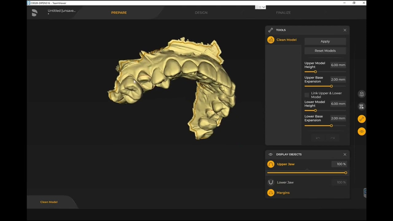 Model Builder inLab SW22: Working Model Workflow - YouTube