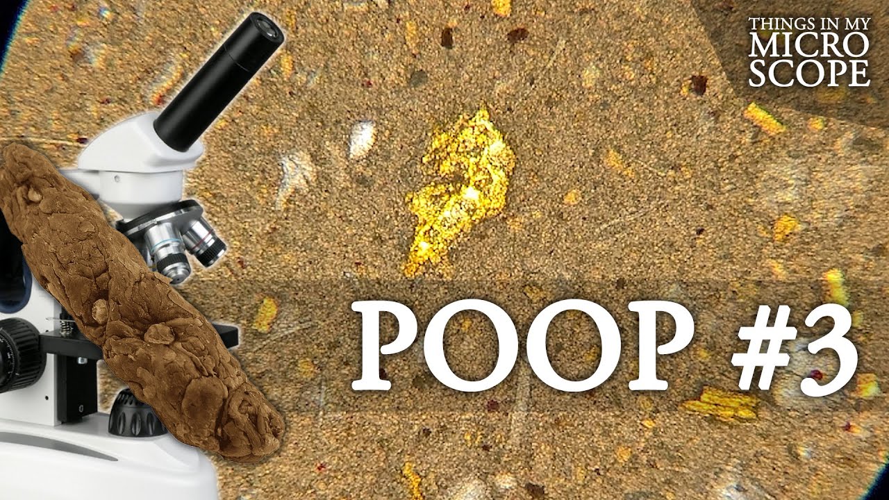 POOP UNDER MICROSCOPE #3 - 100X 250X 1000X 4K - YouTube