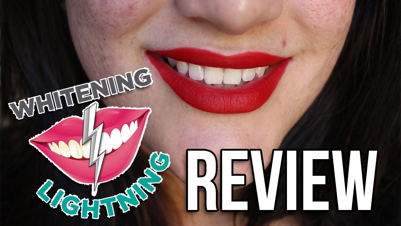 Whitening Lightning Dial-A-Smile Review + 70% OFF DISCOUNT CODE - YouTube
