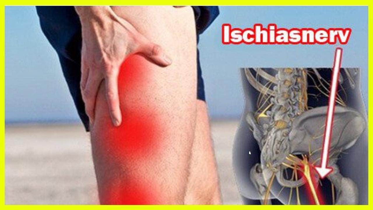 Wie bewegen bei Ischias-Schmerz? - YouTube