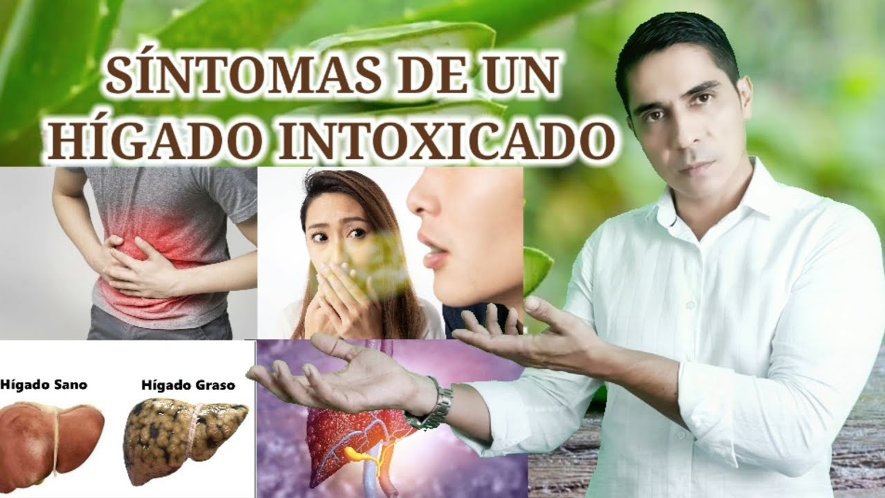 SÍNTOMAS DE UN HÍGADO INTOXICADO - YouTube