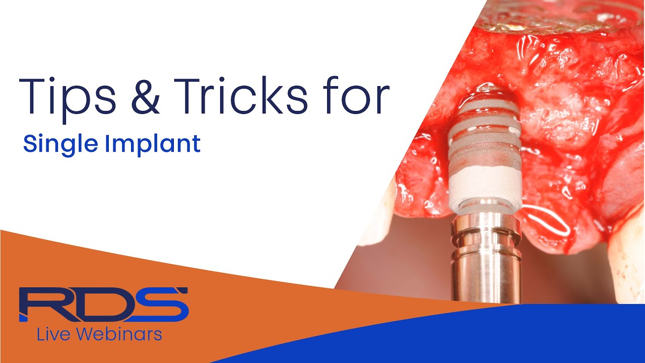Tips and tricks for the single implant - YouTube