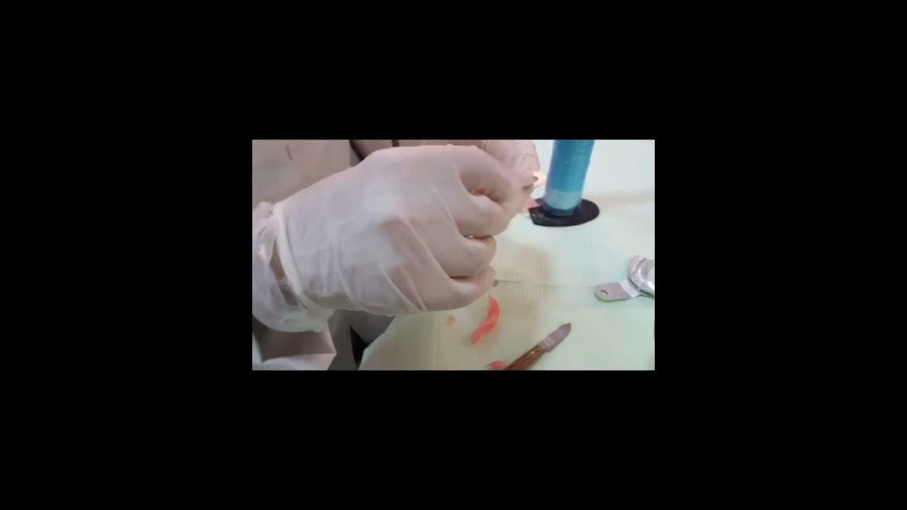 Maxillary Primary Impression for Complete Denture - YouTube