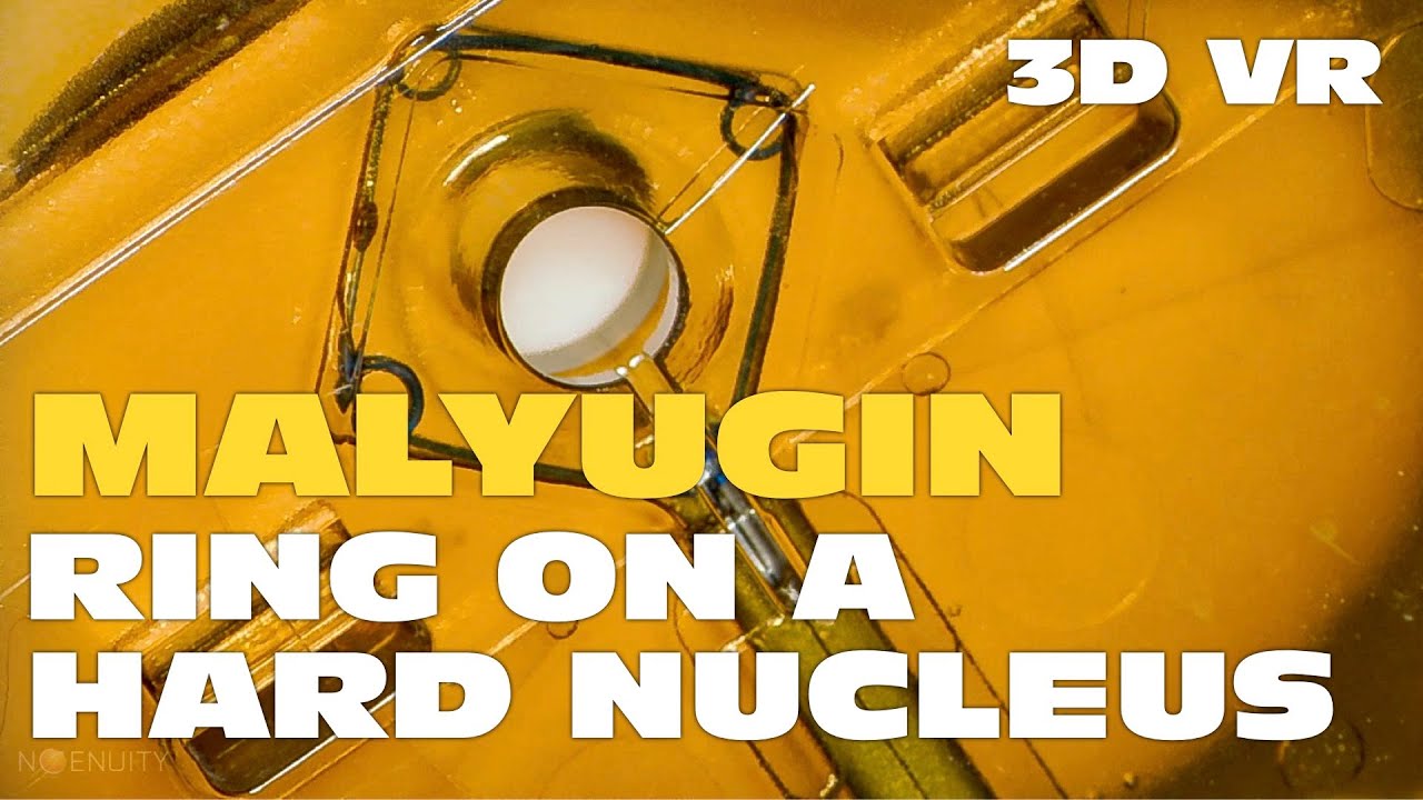 3D Phaco Clip #119 - Malyugin Ring And Submarine Chop (VR Headset ...