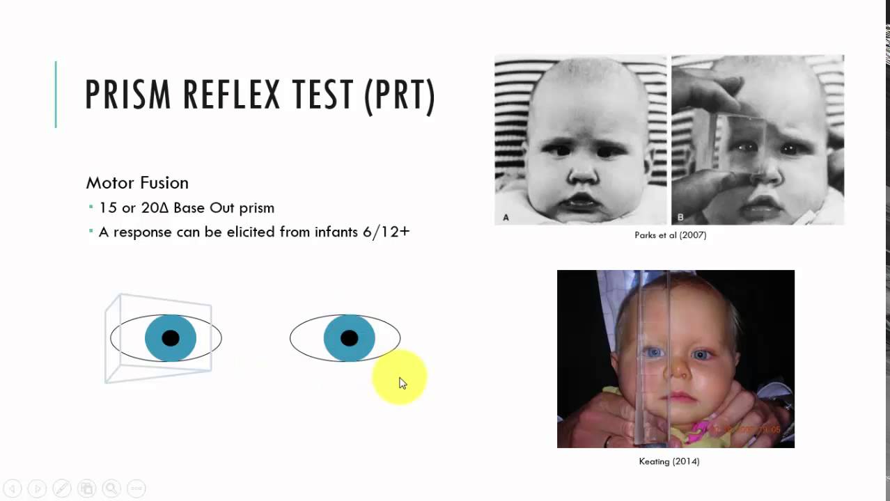 Prism Reflex Test - YouTube