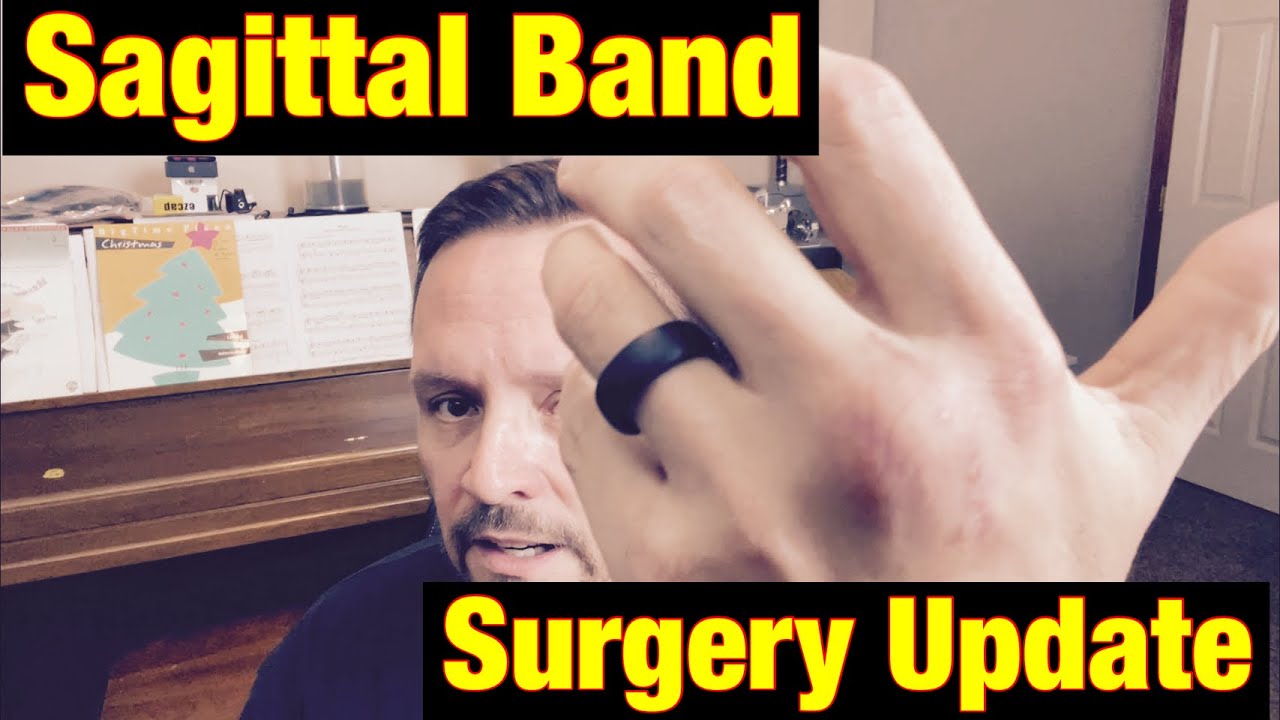 Sagittal Band Surgery Update - YouTube
