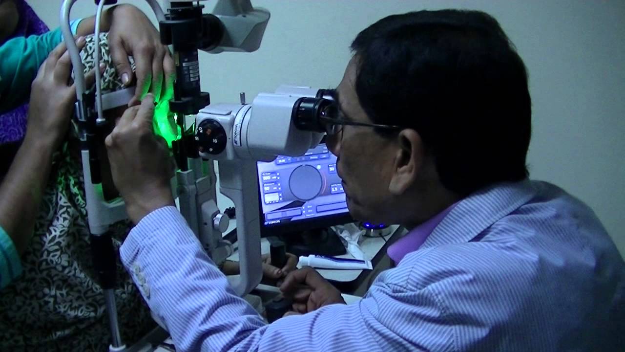 Argon Laser Suture Lysis - YouTube