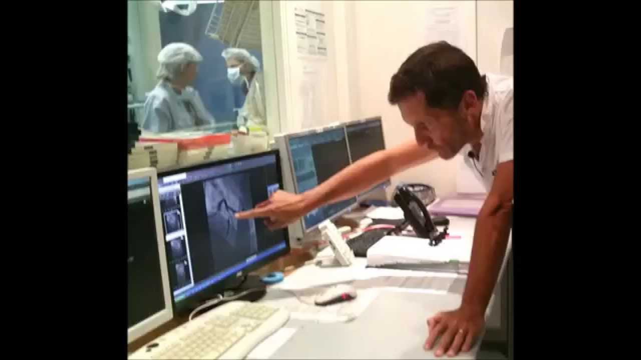 France Bleu Azur - Itw Professeur Emile Ferrari - CHU de Nice - YouTube