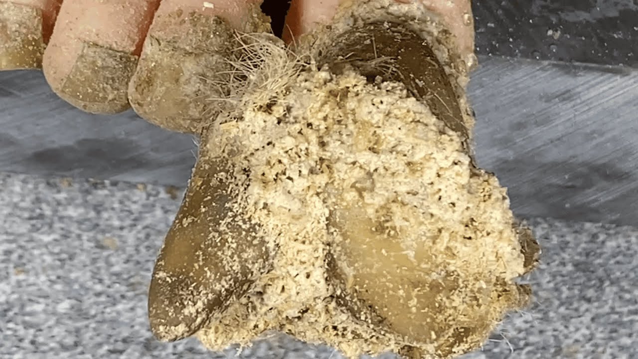 toenails weird, Onychomycosis causes severe degeneration m2 0987 - YouTube