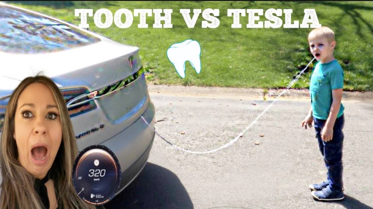 PULLING HIS TOOTH WITH THE TESLA?! 😱😂 - YouTube