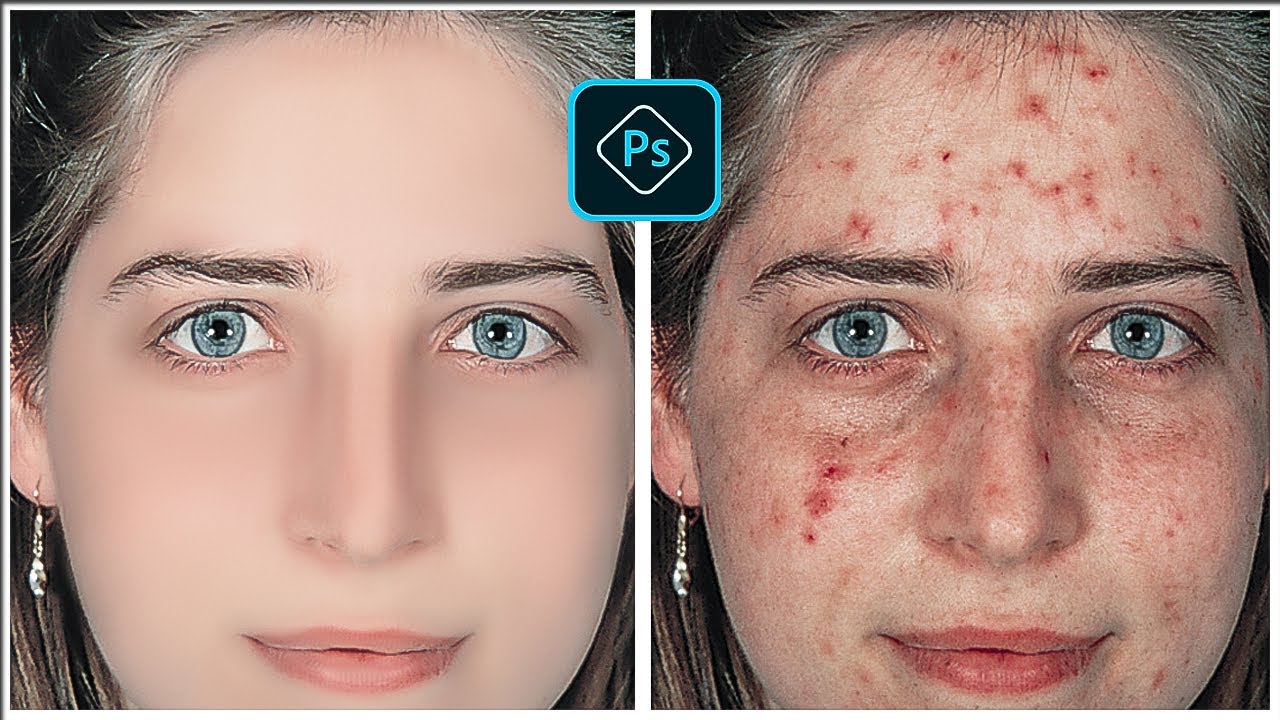 How To Remove Face Pimples In Photoshop In Photoshop Retouching Tutorial YouTube how-to-remove-face-pimples-in-photoshop-in-photoshop-retouching-tutorial-youtube