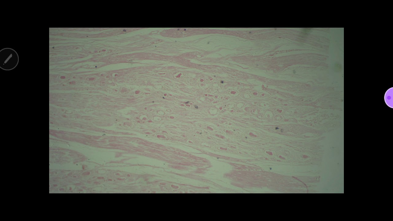 General histology slides revision - YouTube