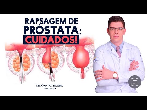 RASPAGEM DE PRÓSTATA: VEJA ISSO ANTES DA CIRURGIA DE RTU DE PRÓSTATA ...