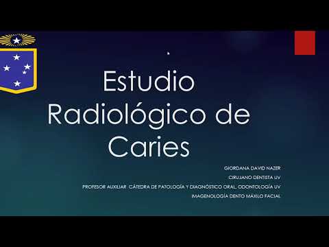 Estudio radiológico de la caries. - YouTube
