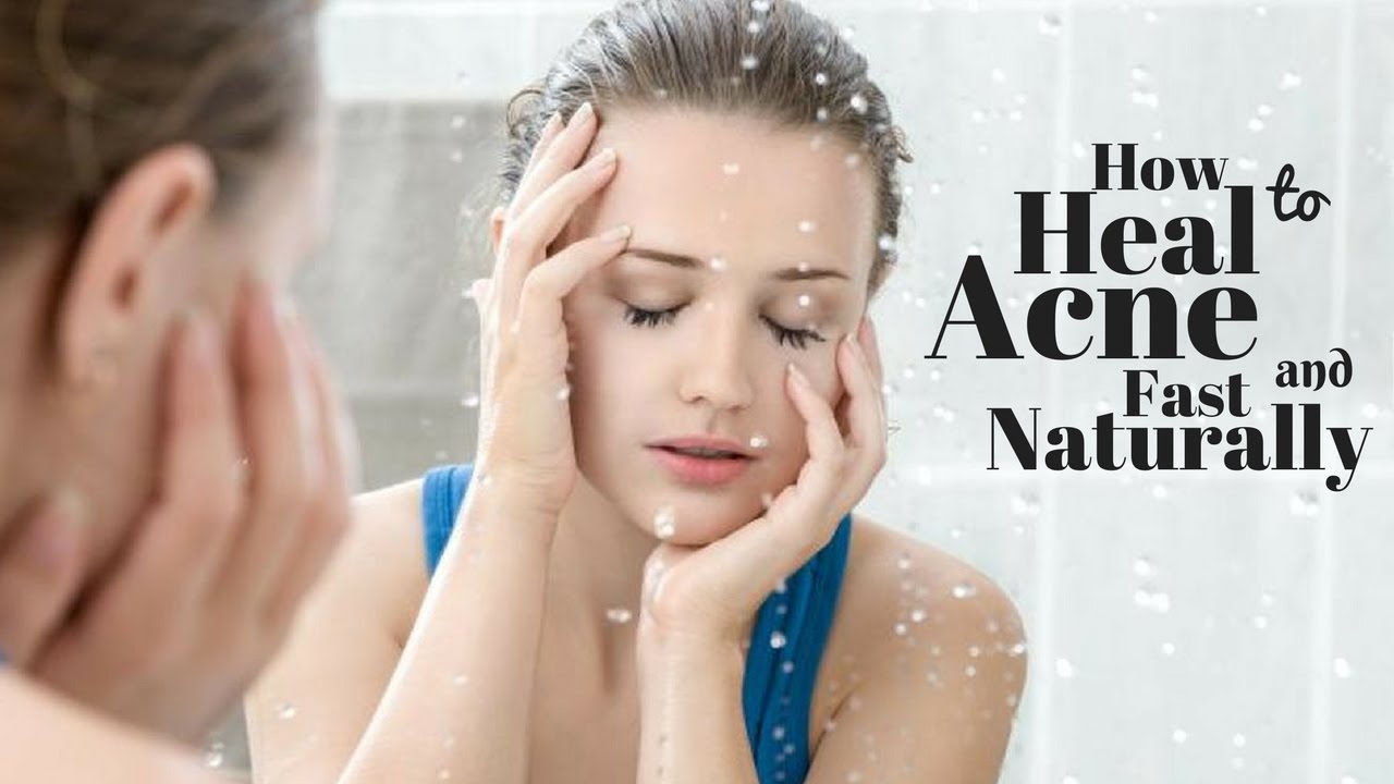 How To Heal Acne Fast And Naturally - YouTube