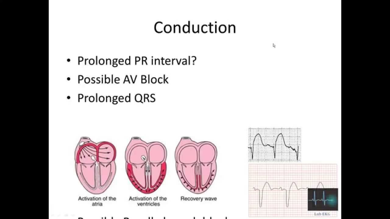 How To Read ECG 5 Steps YouTube How To Read ECG 5 Steps YouTube
